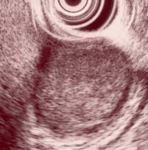 Advanced Endoscopic Procedures to Diagnose and Treat Gastrointestinal ...