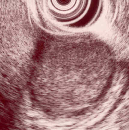 Advanced Endoscopic Procedures to Diagnose and Treat Gastrointestinal ...